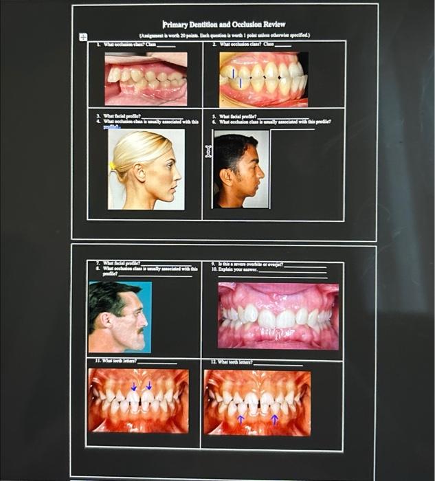 Solved Primary Dentition and Occlusion Review (Assignment | Chegg.com