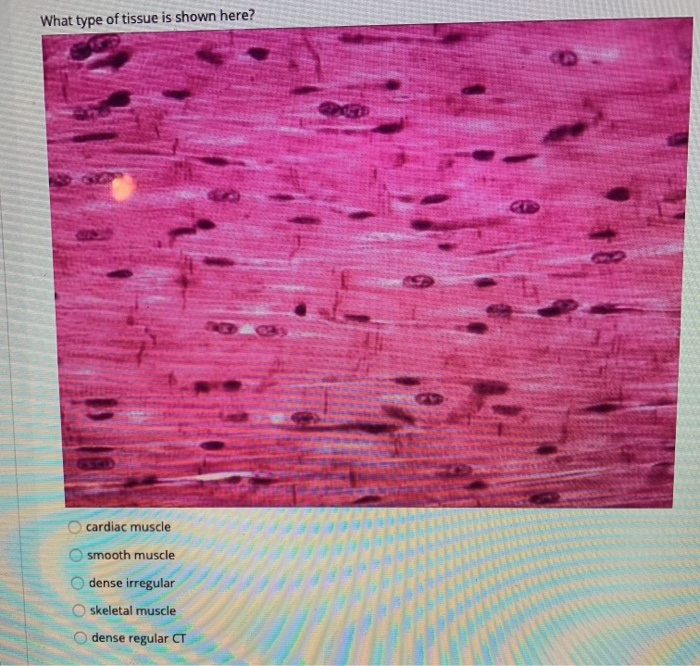 Solved What type of tissue is shown here? cardiac muscle | Chegg.com