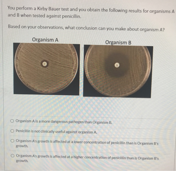 Solved In this lab we measure the of the zone of inhibition. | Chegg.com