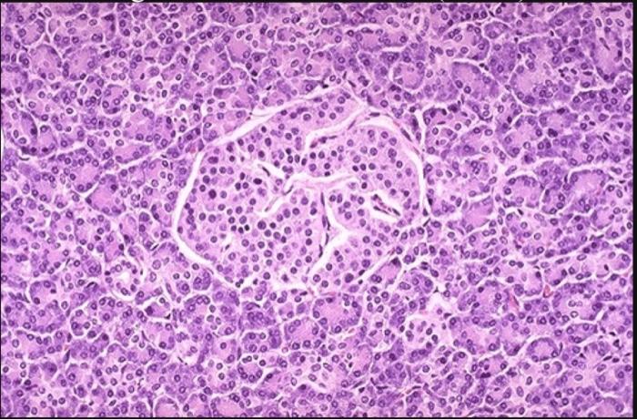 Solved Endocrine Histology :Pancreas: Note the tissue | Chegg.com