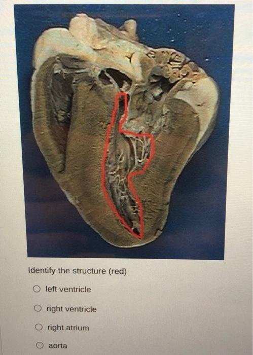 Solved Identify the structure (red) left ventricle right | Chegg.com