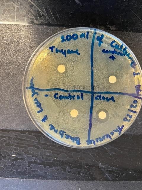 disc diffussion Assay experiment ,1-calculate the | Chegg.com