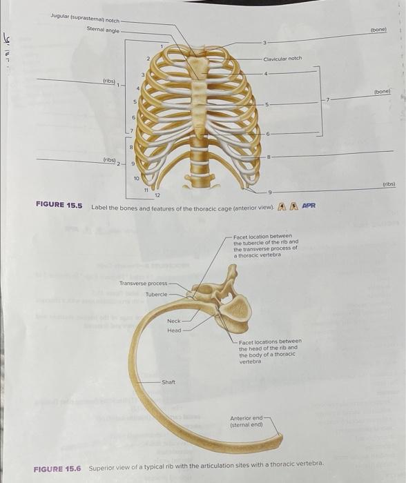 Solved Jugular suprastemal notch Sternal angle bone in | Chegg.com
