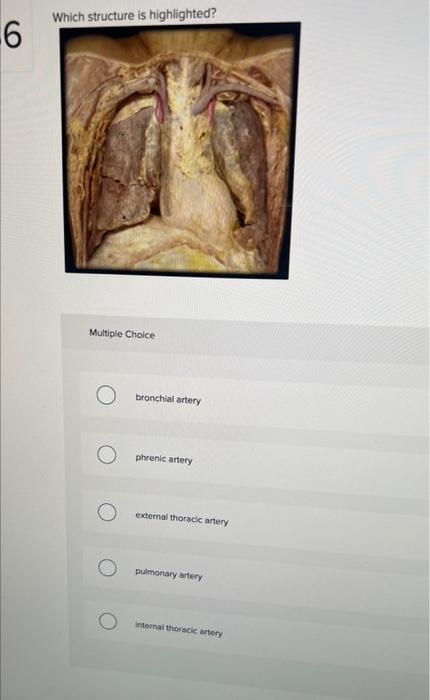 Solved Which structure is highlighted? Multiple Choice right | Chegg.com