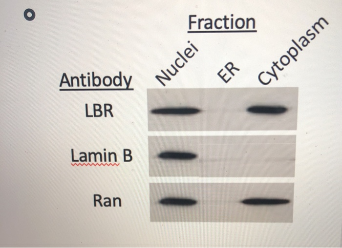 Solved Lamin B Receptor Paper In animals, Lamin B Receptor | Chegg.com