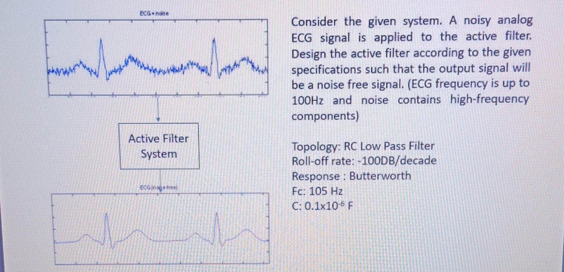 Consider the given system. A noisy analog ECG signal | Chegg.com