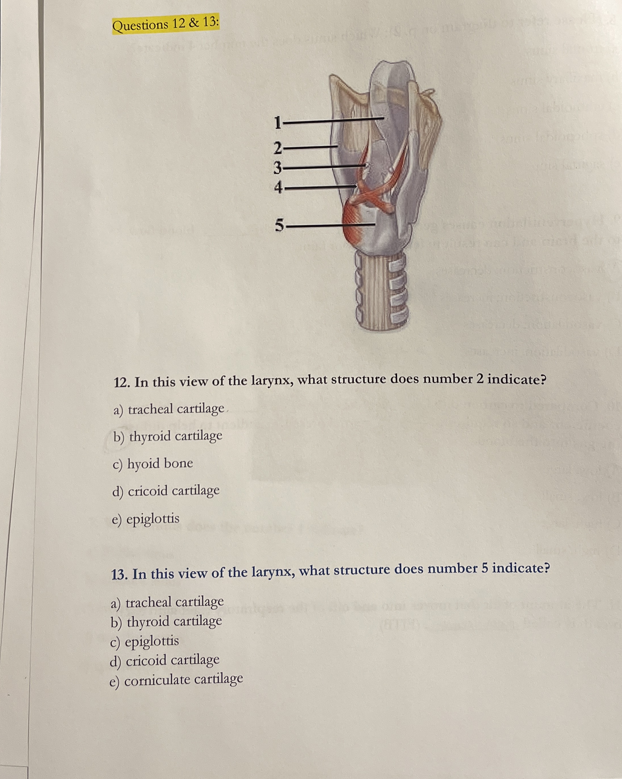 Solved Questions 12 ﻿& 13:12. ﻿In this view of the larynx, | Chegg.com