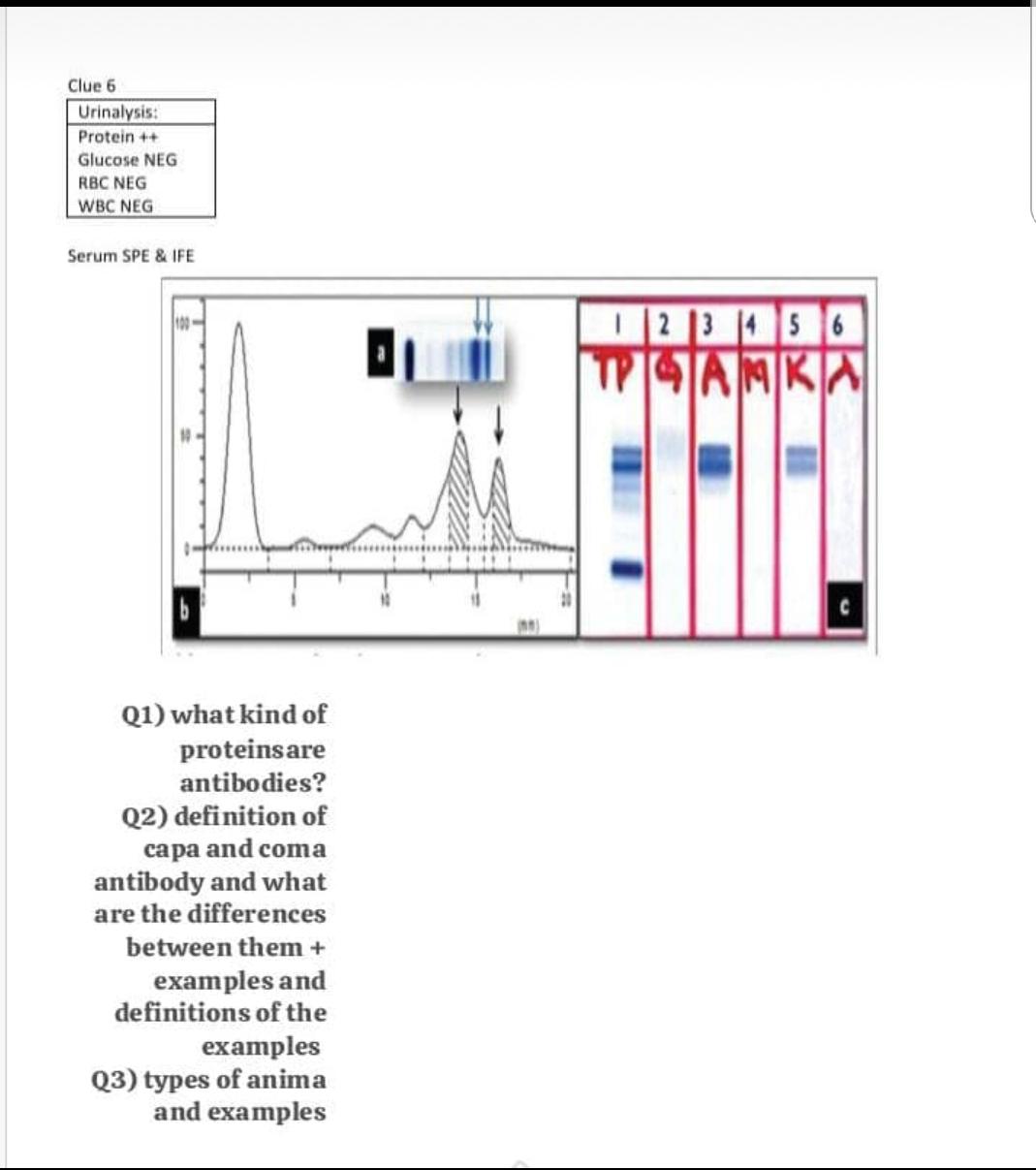 Solved Clue 6\table[[Urinalysis:],[Protein ++],[Glucose | Chegg.com