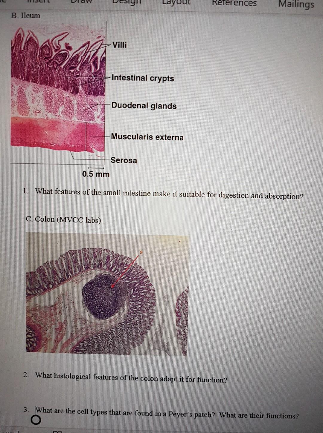 Solved References Mailings B. Ileum Villi Intestinal crypts | Chegg.com