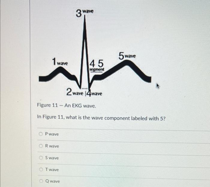 Solved 3 wave 5 wave I wave 45 segment 2w wave 4wave Figure | Chegg.com