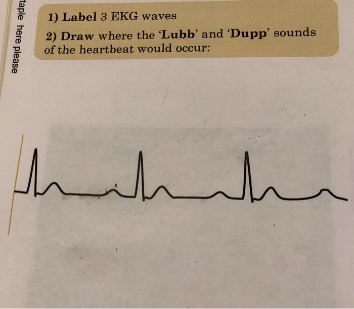 Solved taple here please 1) Label 3 EKG waves 2) Draw where | Chegg.com