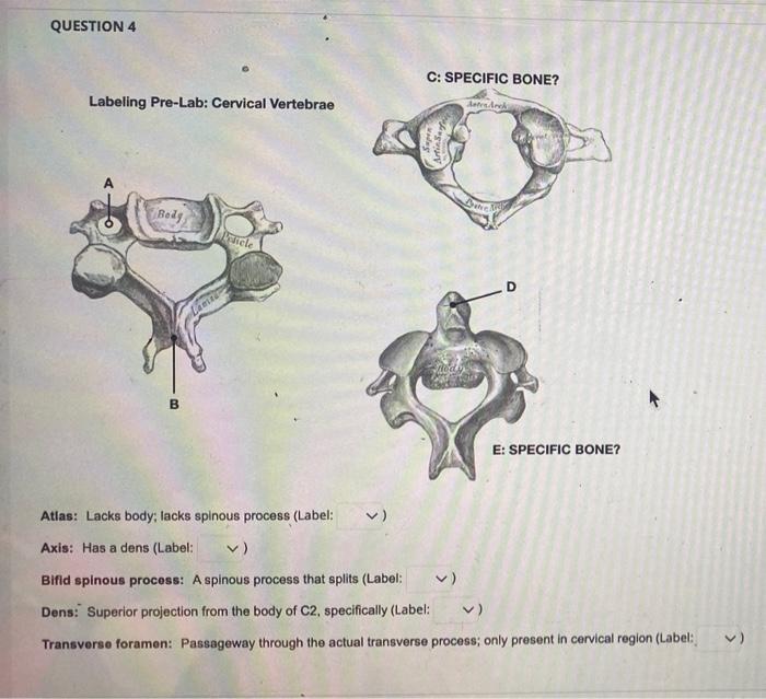 Solved Labeling Pre-Lab: Specific Features of Most Vertebrae | Chegg.com