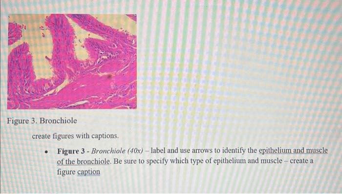 Solved ure 3. Bronchiole create figures with captions. - | Chegg.com