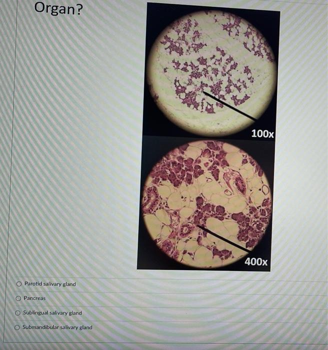 Solved Organ? 100x 400x O Parotid salivary gland Pancreas O | Chegg.com