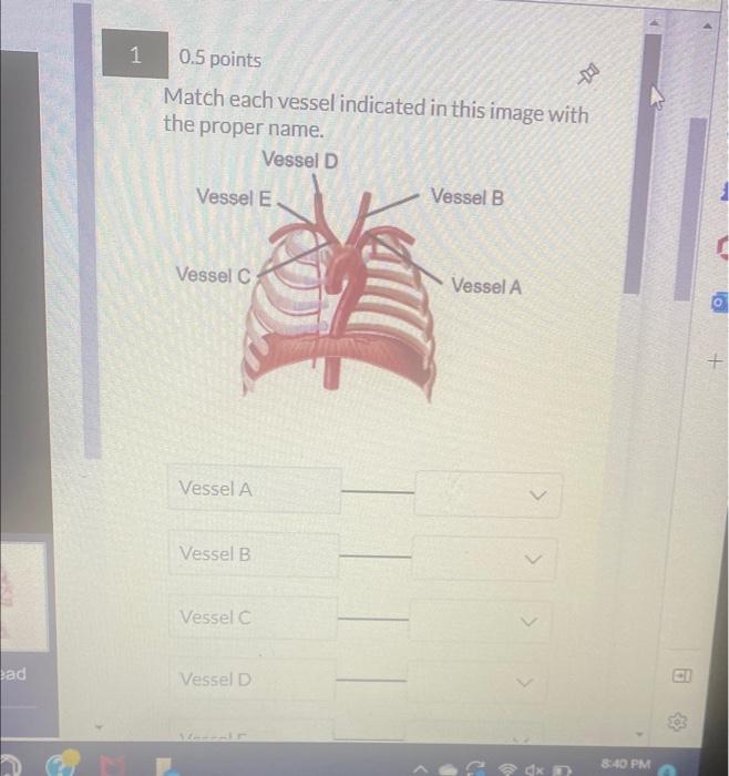 Solved Match each vessel indicated in this image with the | Chegg.com