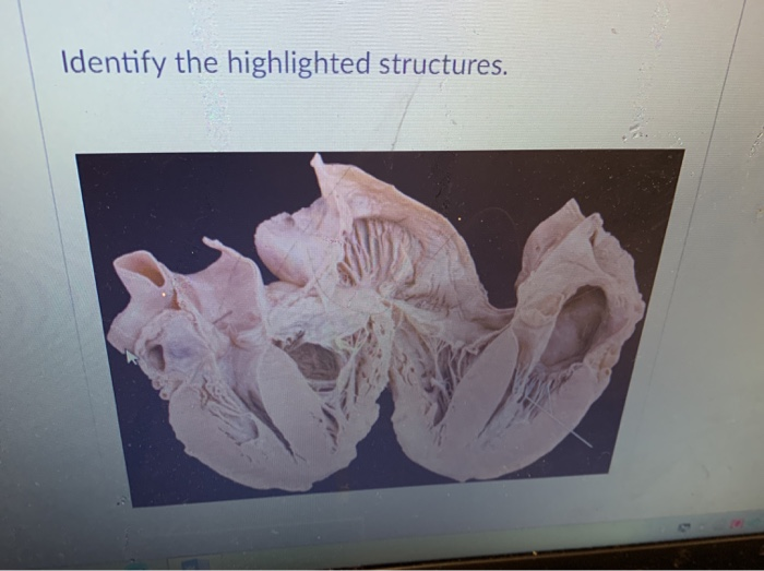 Solved Identify the highlighted structures. | Chegg.com