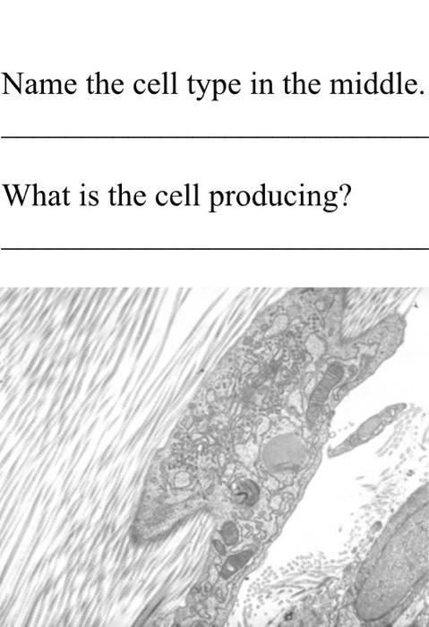 Solved Name the cell type in the middle. What is the cell | Chegg.com