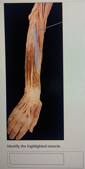 Solved Identify the highlighted muscle. | Chegg.com