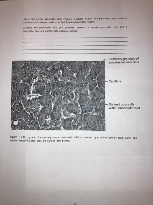 Solved PART C ASSESSMENTS Match the endocrine gland in | Chegg.com Solved PART C ASSESSMENTS Match the endocrine gland in | Chegg.com