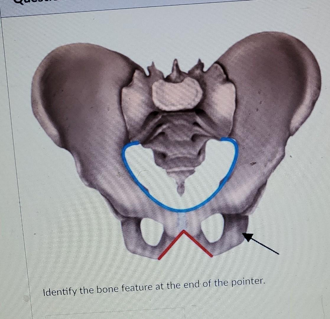 Solved Identify the bone feature at the end of the pointer. | Chegg.com