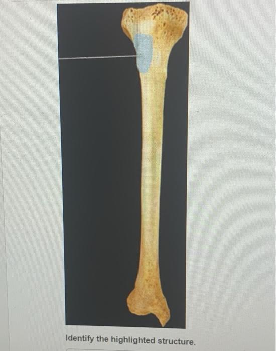 Solved Identify the highlighted bone. Identify the | Chegg.com