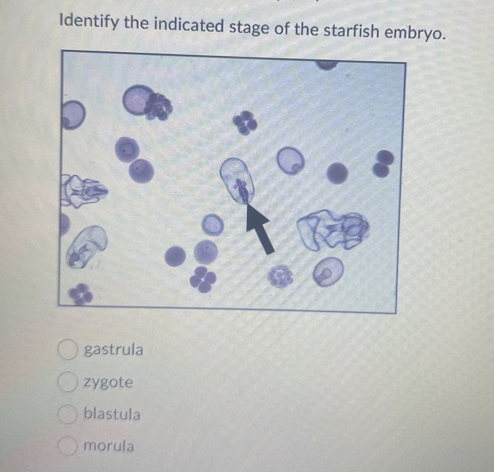 Solved Identify the indicated stage of the starfish | Chegg.com