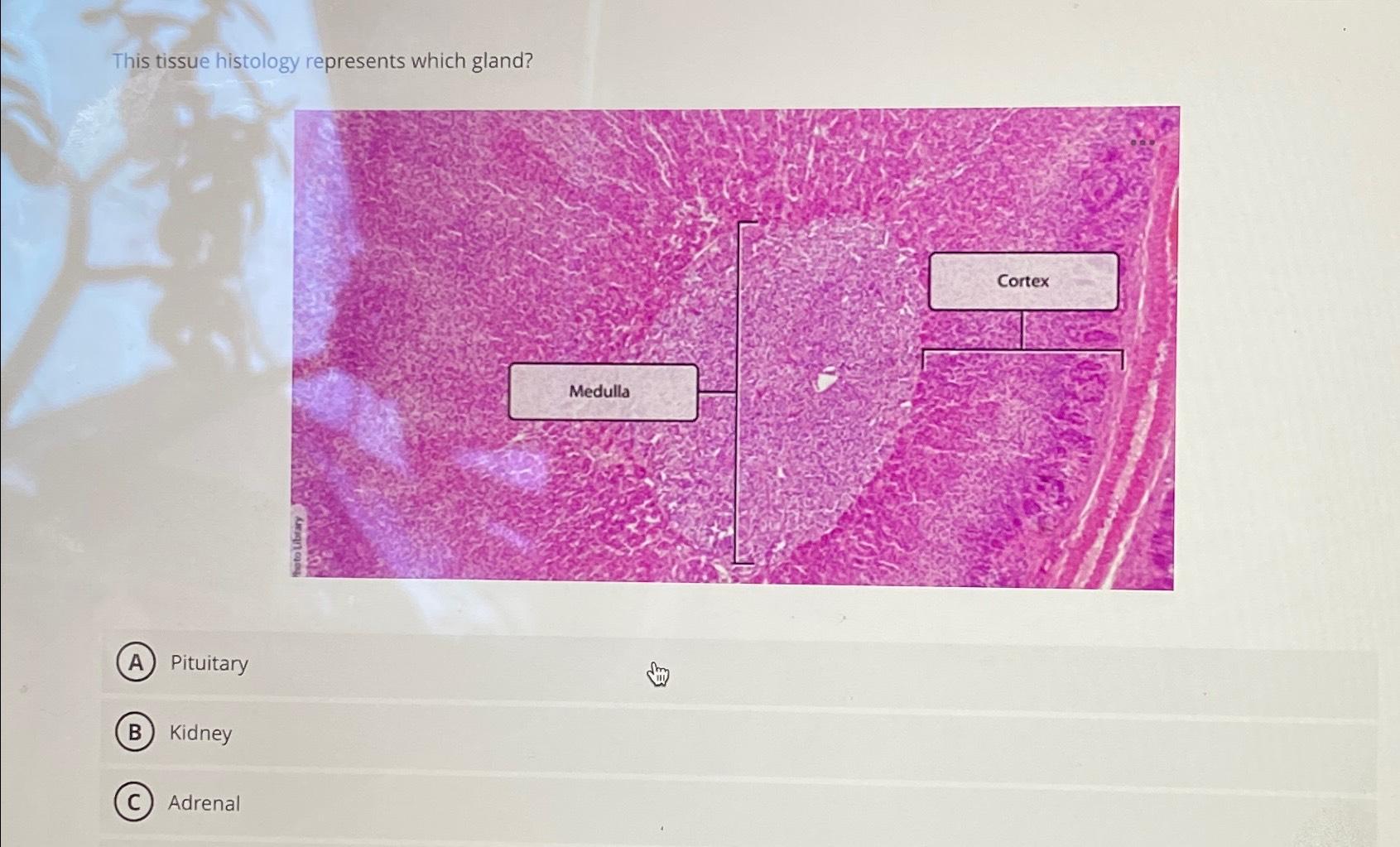 Solved This tissue histology represents which | Chegg.com