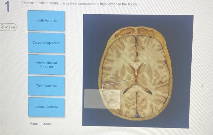 Solved Determine Which Ventricular System Component Is
