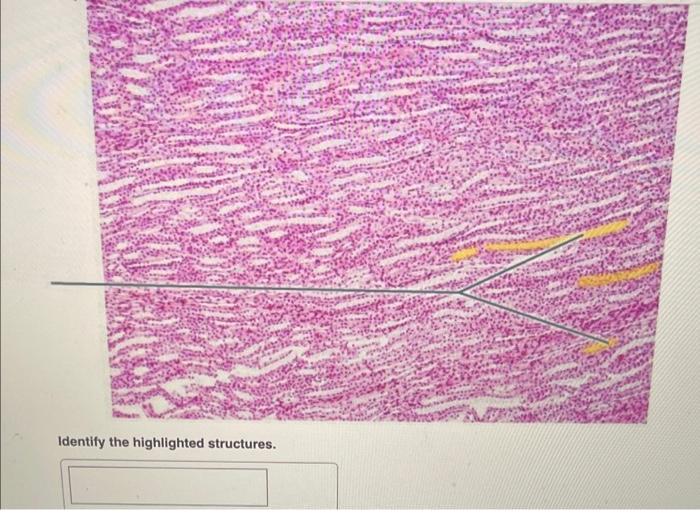 Solved Identify the highlighted structures. | Chegg.com
