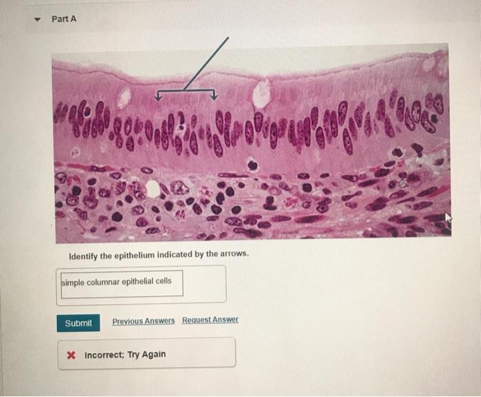 Solved Part A Identify the highlighted structure. striations | Chegg.com
