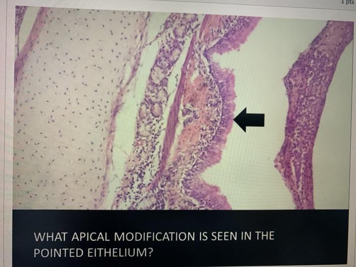 Solved IDENTIFY POINTED STRUCTURE WHAT STRUCTURE IS LINED | Chegg.com Solved IDENTIFY POINTED STRUCTURE WHAT STRUCTURE IS LINED | Chegg.com