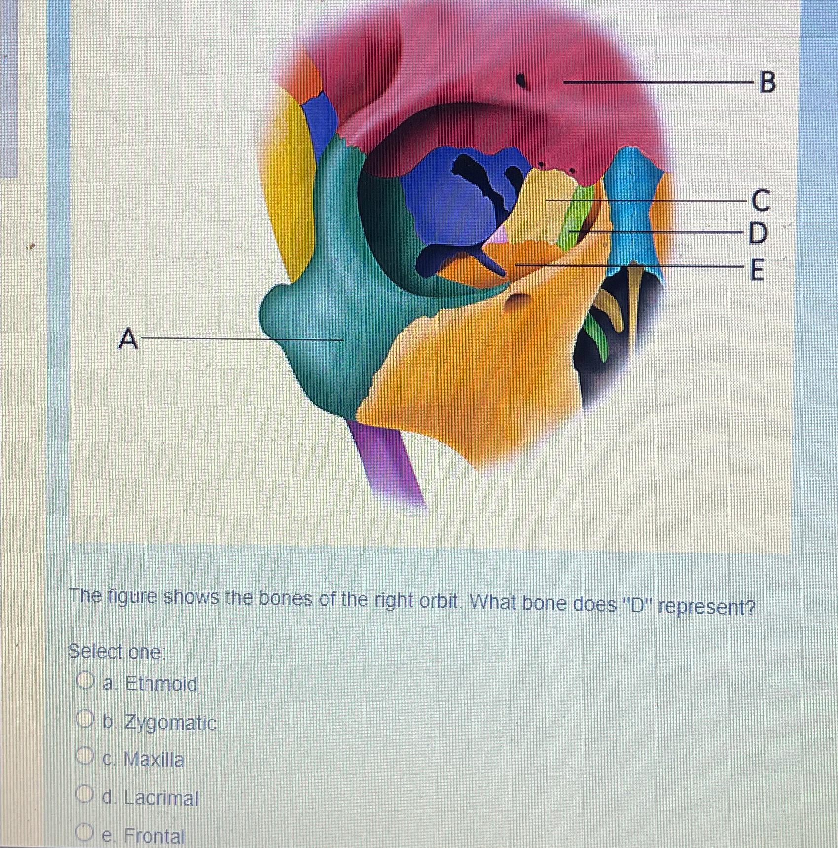 Solved The figure shows the bones of the right orbit. What | Chegg.com