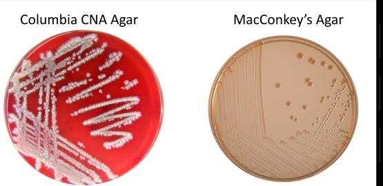 Solved interpret these results, is it alpha or beta | Chegg.com