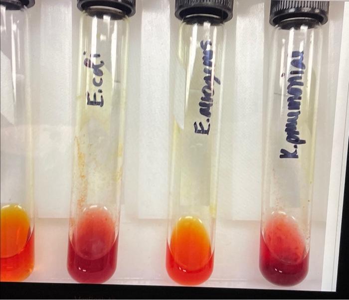 Solved PART B: Methyl Red Test and Voges-Proskauer Test | Chegg.com