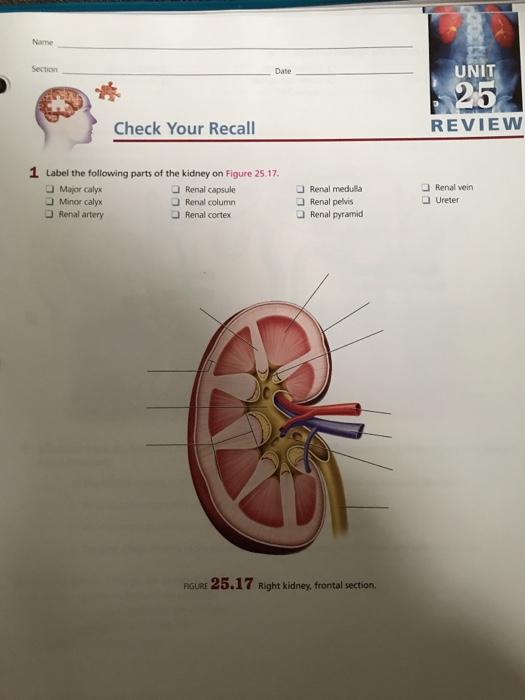 Solved Name Section Date UNIT 25 REVIEW Check Your Recall 1 | Chegg.com