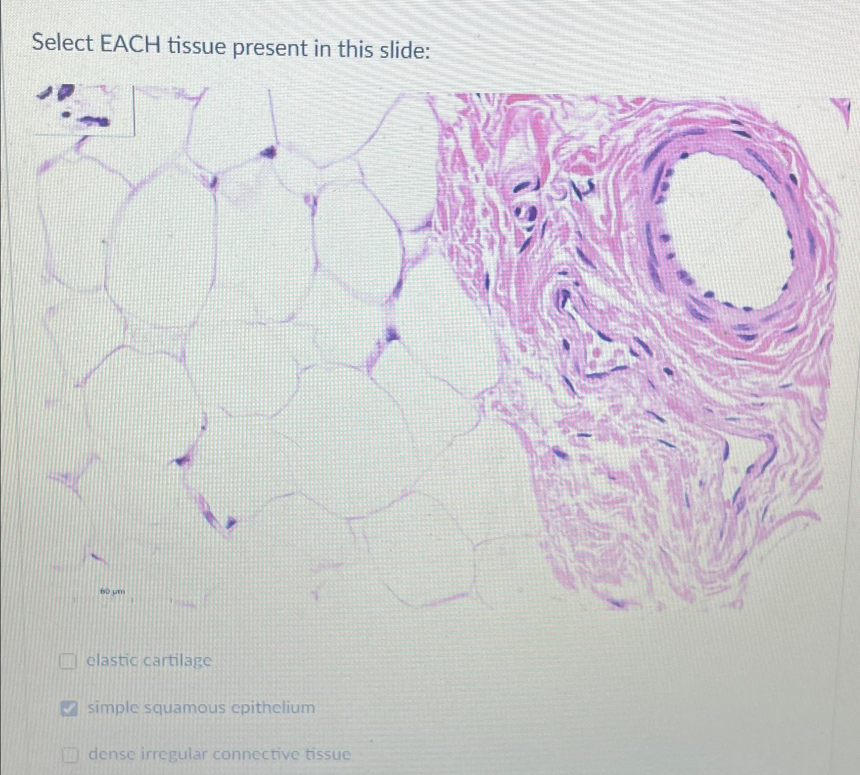 Solved Select EACH tissue present in this slide:clastic | Chegg.com