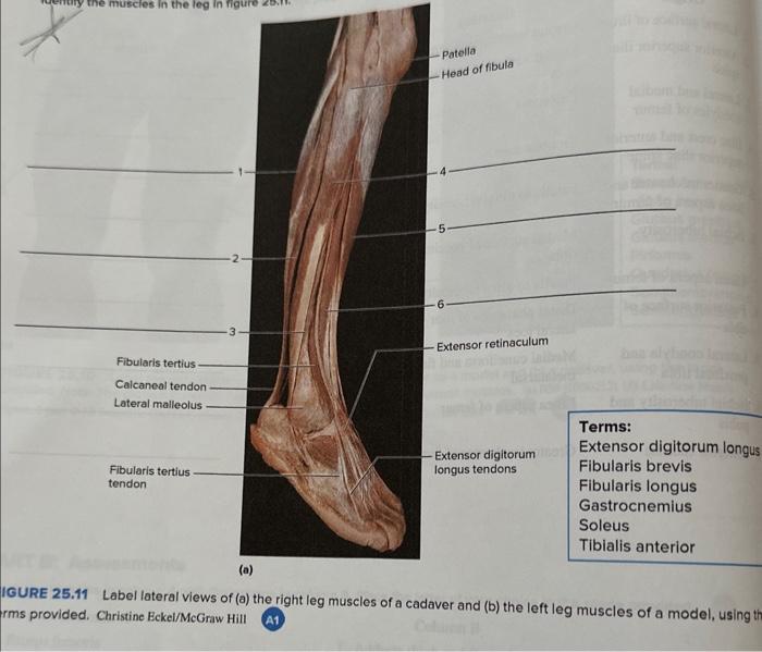 Solved IGURE 25.11 Label lateral views of (a) the right leg | Chegg.com