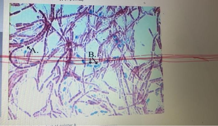 Solved B. A. Identify the structure at pointer A. B. | Chegg.com