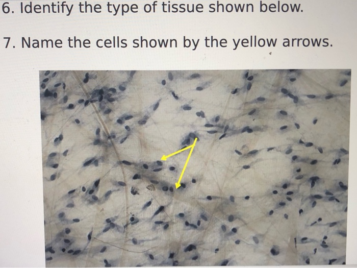 Solved 1. Identify the type of tissue marked by the yellow | Chegg.com