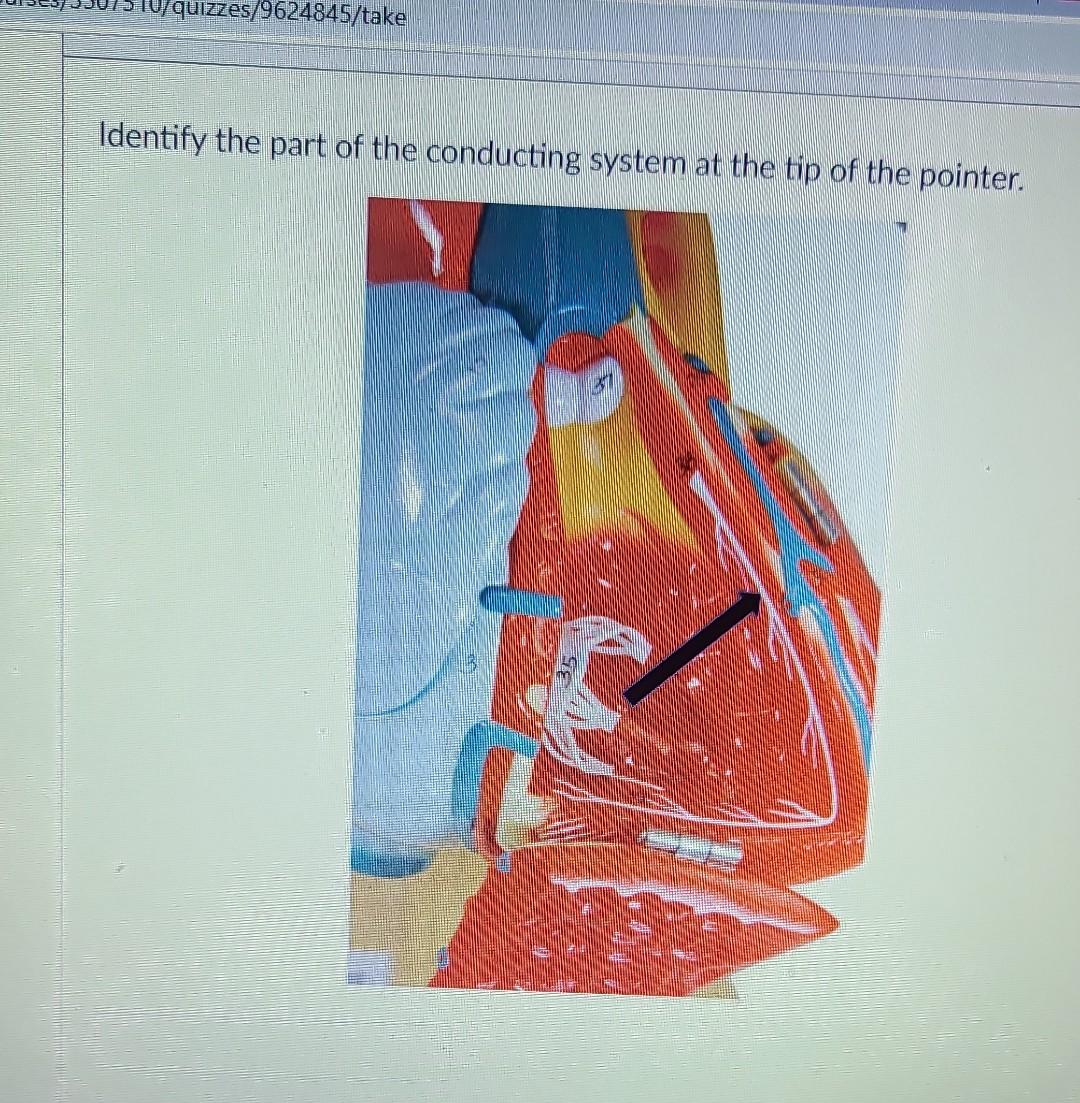 Solved Identify the part of the conducting system at the tip | Chegg.com