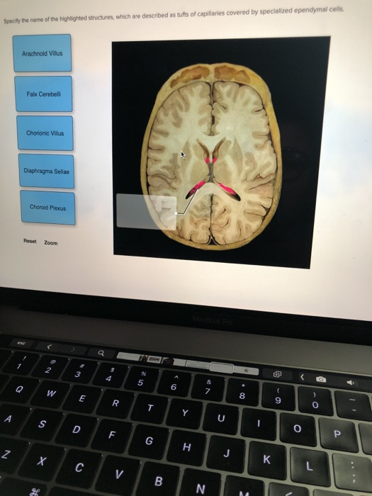 Solved Specify the name of the highlighted structures, which | Chegg.com