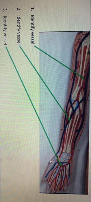 Solved 1. Identify vessel 2. Identify vessel 3. Identify | Chegg.com