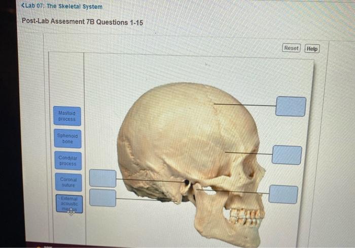 Solved Post-Lab Assesment 7B Questions 1-15 | Chegg.com