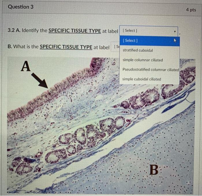Solved Question 3 4 pts 3.2 A. Identify the SPECIFIC TISSUE | Chegg.com