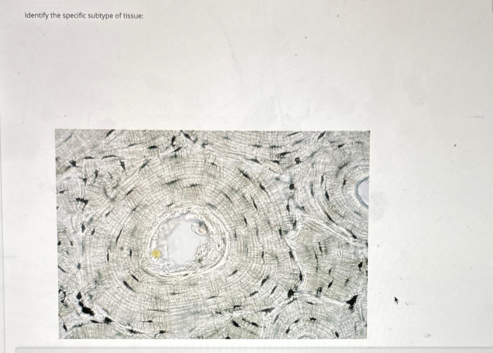 Solved Identify the specific subtype of tissue: | Chegg.com