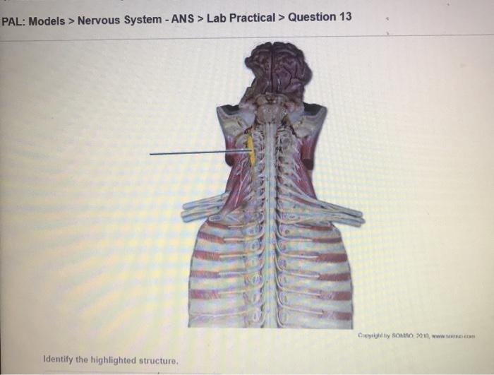 Solved PAL: Models > Nervous System - ANS > Lab Practical > | Chegg.com