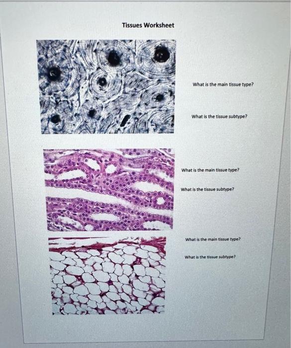 Solved −Tissues Worksheet What is the main tissue type What | Chegg.com