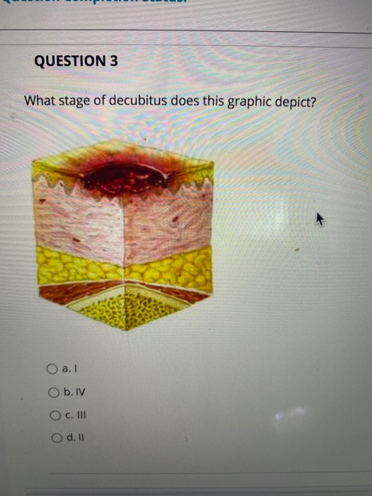 Solved QUESTION 3 What stage of decubitus does this graphic | Chegg.com