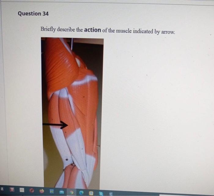 Solved Question 32 Identify one antagonist to the muscle | Chegg.com
