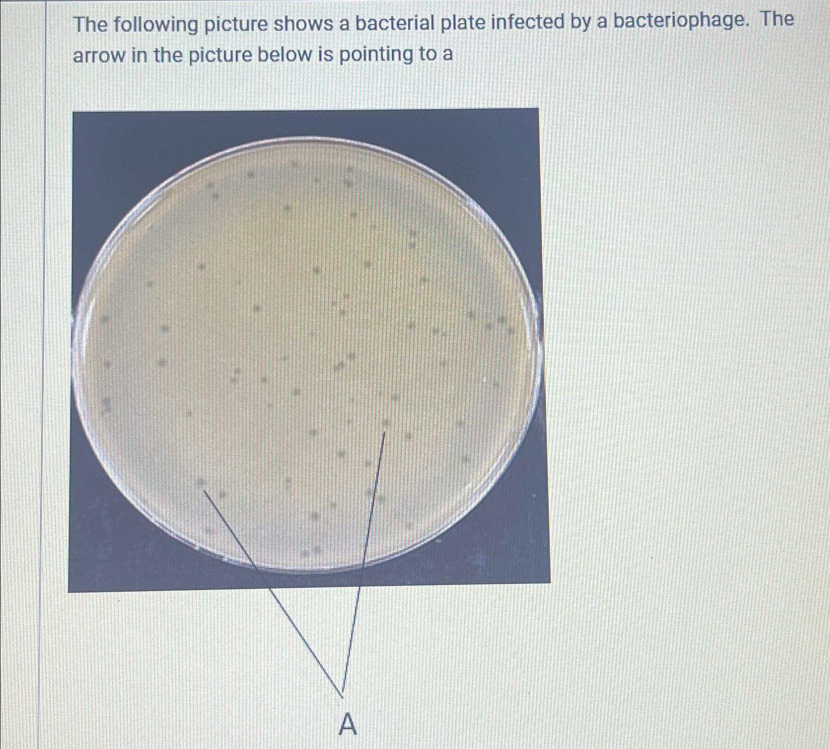 Solved The following picture shows a bacterial plate | Chegg.com